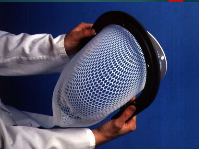 Patient Positioning and Immobilization Devices In Radiotherapy Planning ...