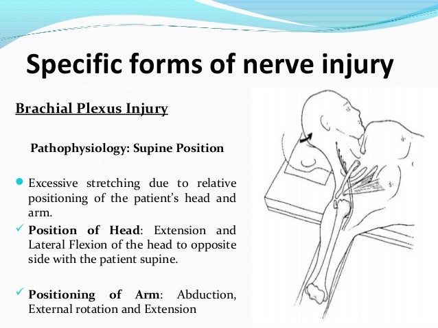 Patient positioning during surgery Dr Rakesh kaward