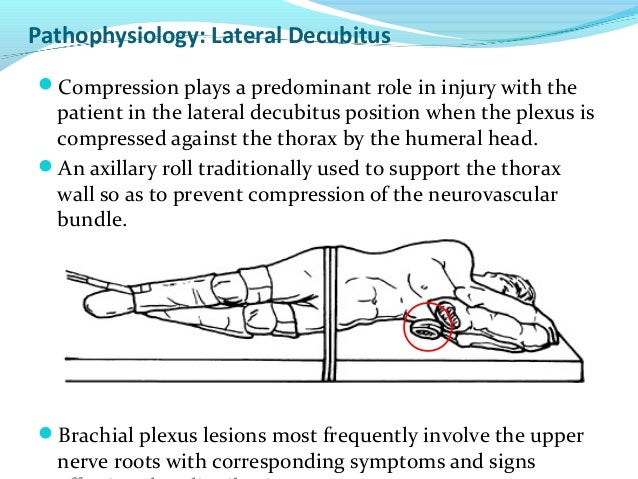 Patient positioning during surgery Dr Rakesh kaward