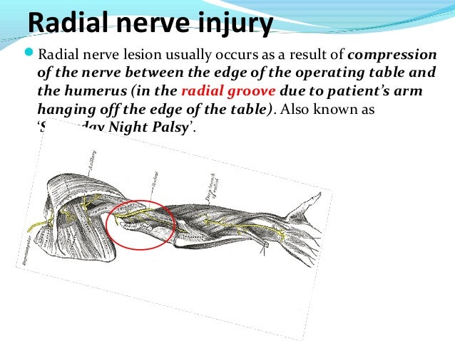 Patient positioning during surgery Dr Rakesh kaward