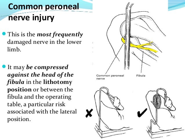 Patient positioning during surgery Dr Rakesh kaward