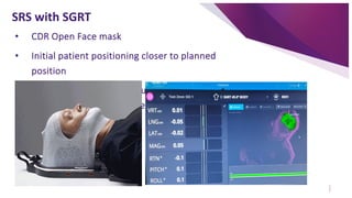 Patient Positioning for SRS Treatments Method to Compare SGRT Deltas vs ...