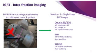 Patient Positioning for SRS Treatments Method to Compare SGRT Deltas vs ...