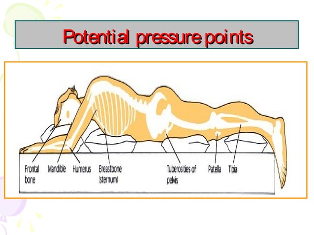 Patient positioning in operating theatre -gihs | PPT