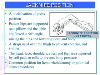 Jackknife Position