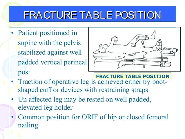 Patient positioning in operating theatre -gihs