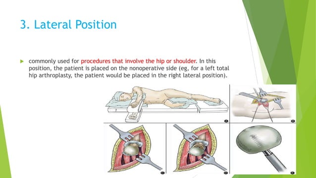 patient positioning in operative room.pptx