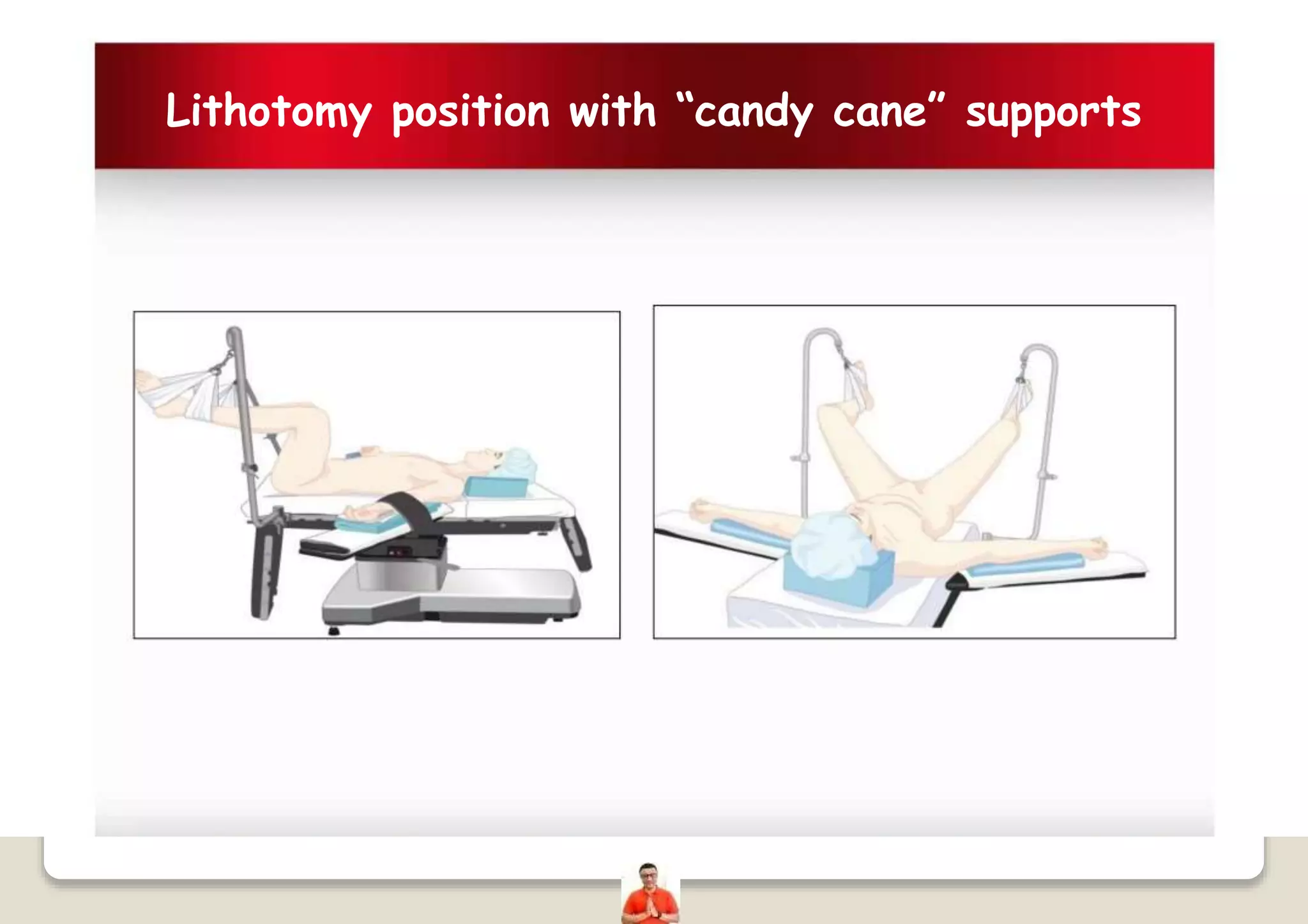 Patient different position under anesthesia | PPTX