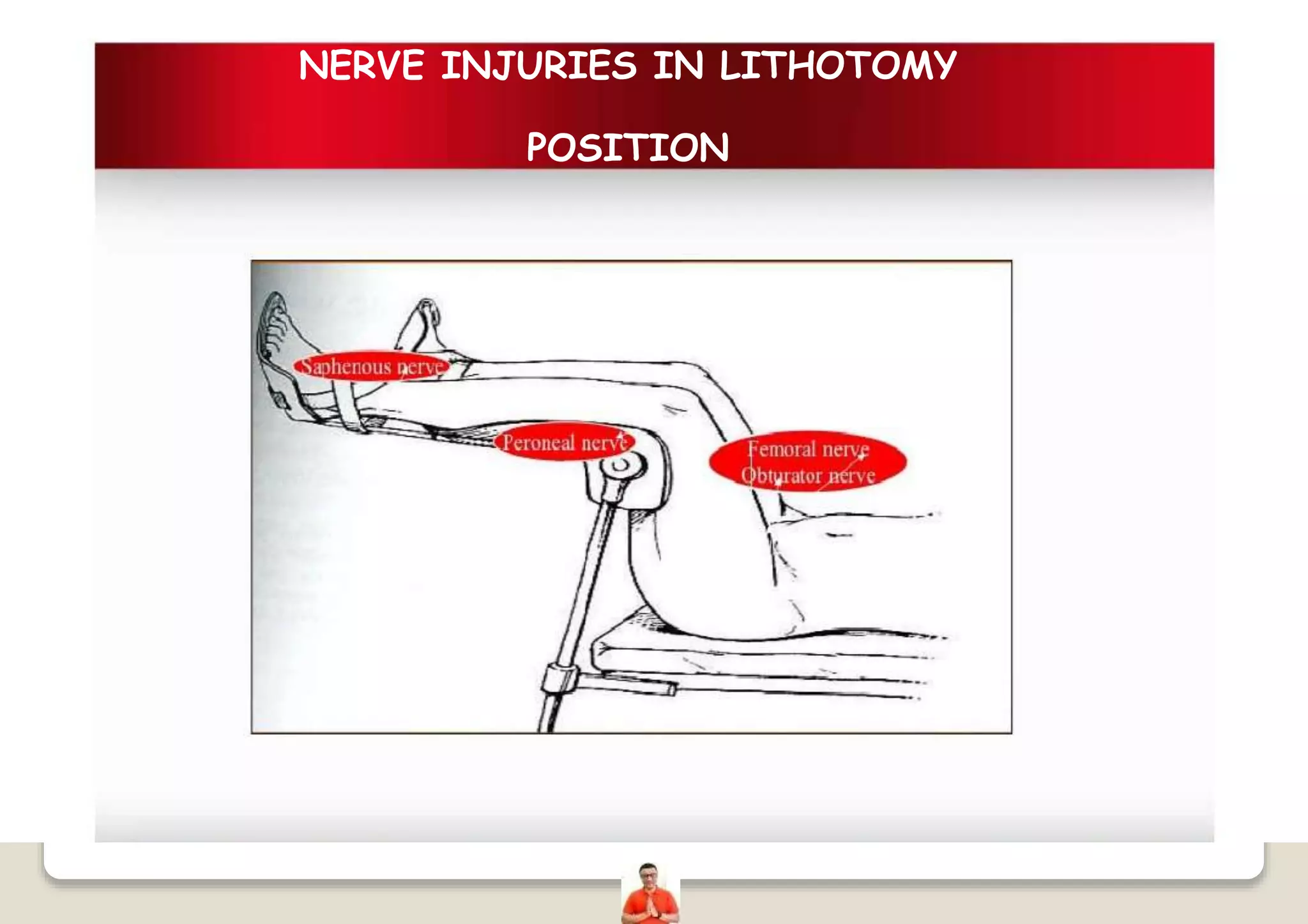 Patient different position under anesthesia | PPTX