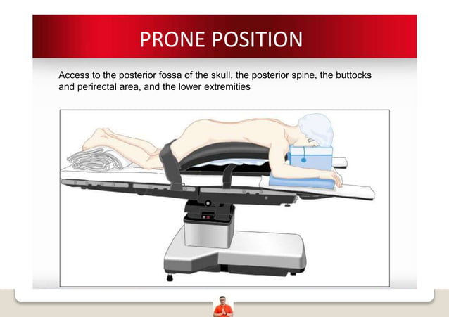 Patient different position under anesthesia | PPT
