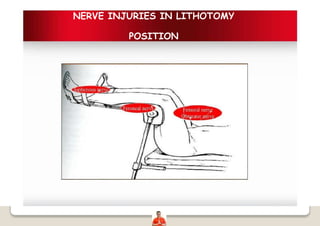 Modified Lithotomy Position