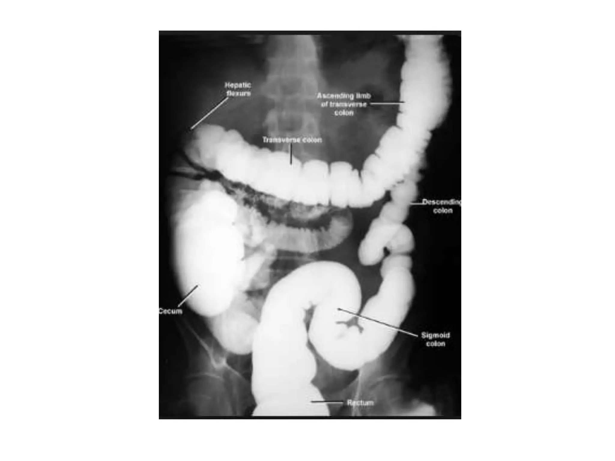 Patient preparation for radiological procedure | PPTX
