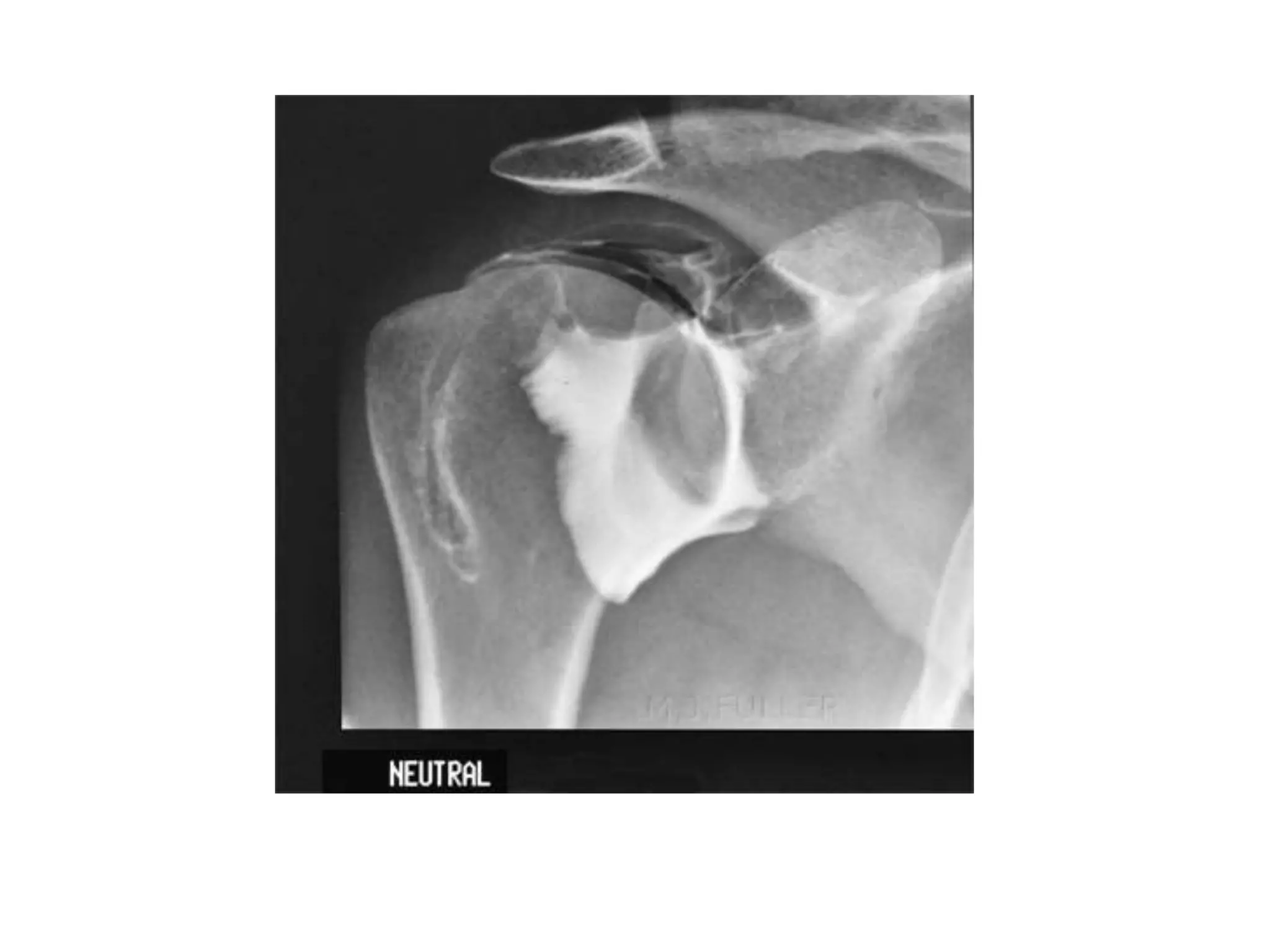 Patient preparation for radiological procedure | PPTX