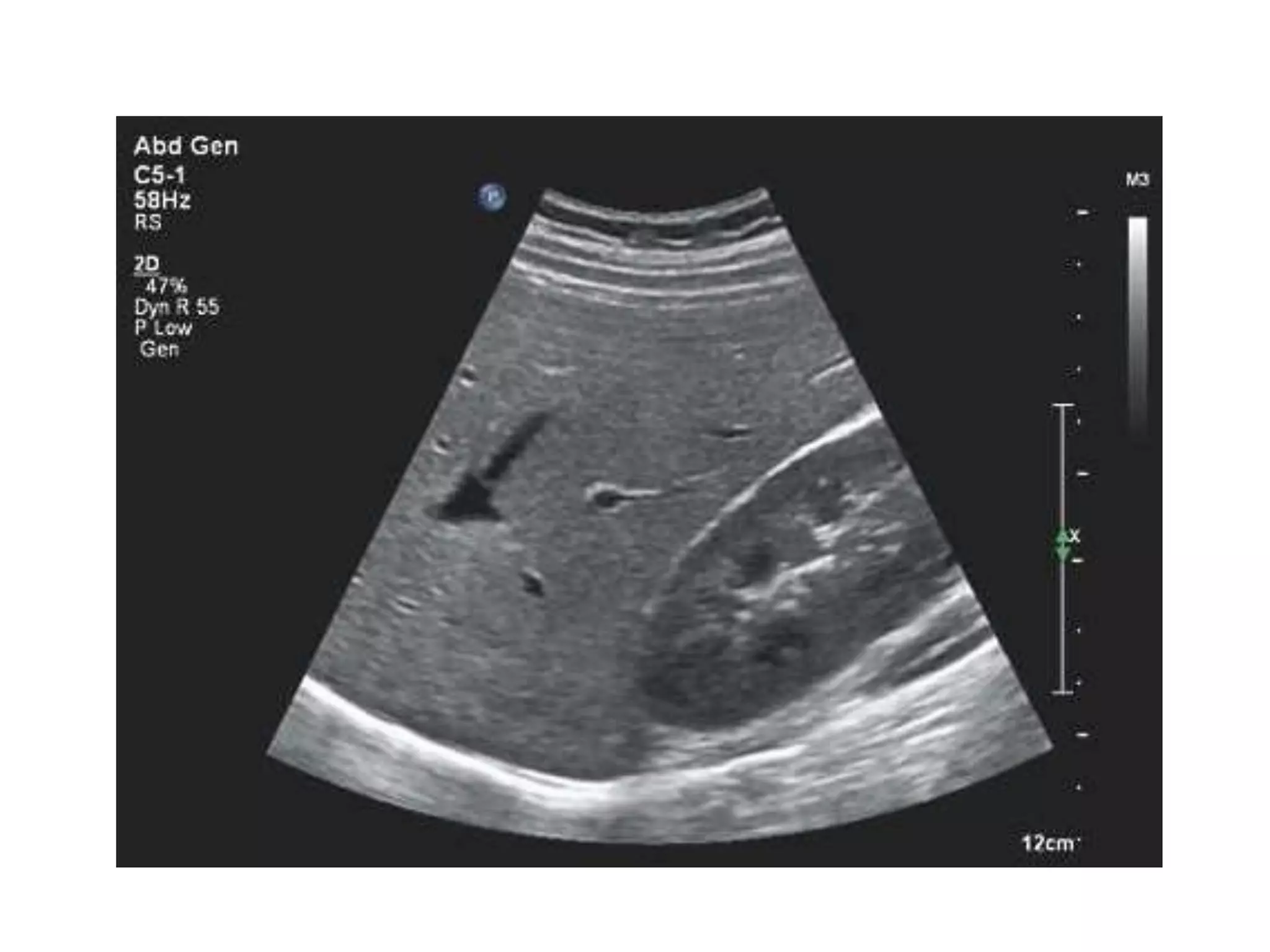 Patient preparation for radiological procedure | PPTX
