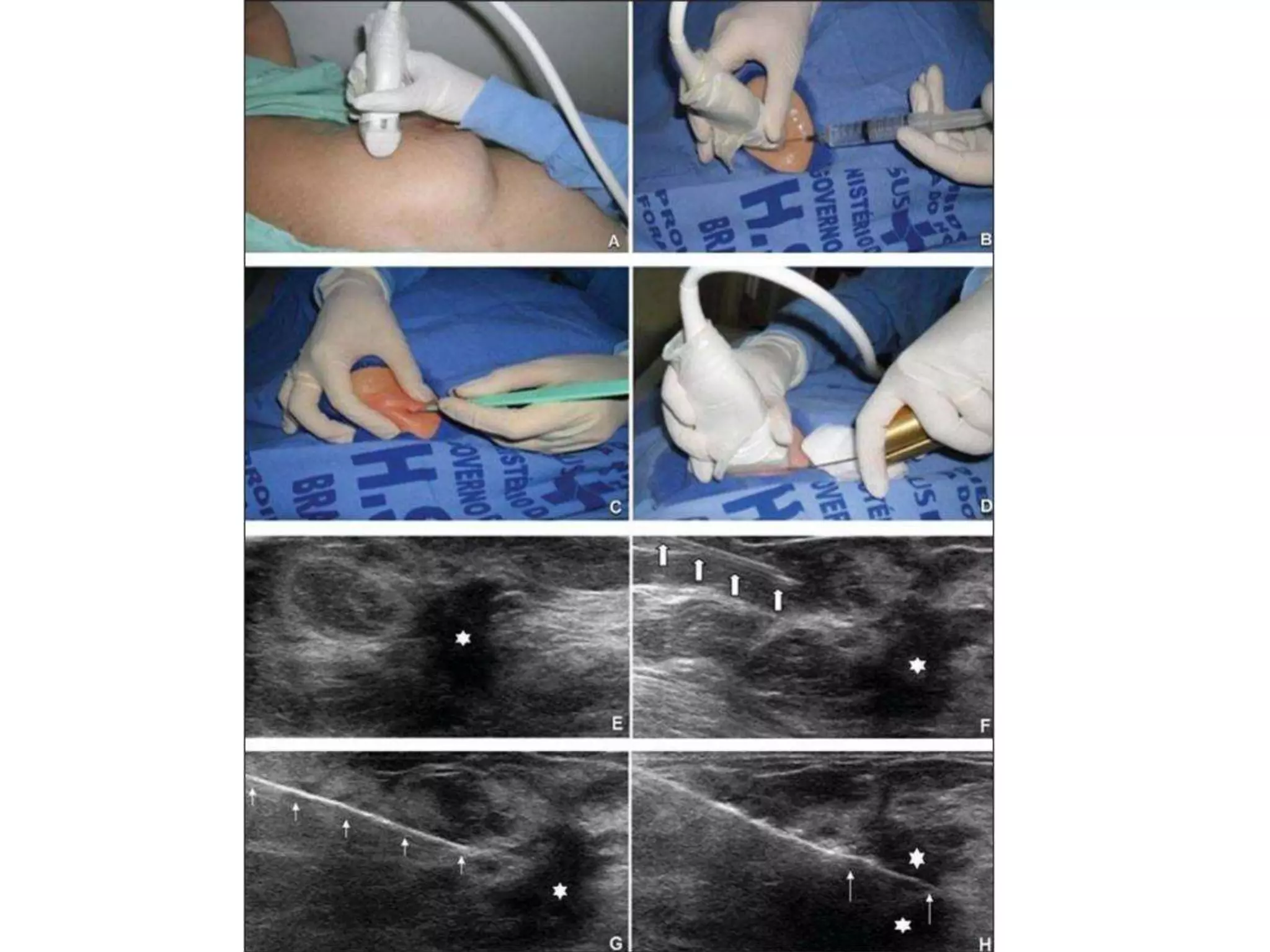 Patient preparation for radiological procedure | PPTX