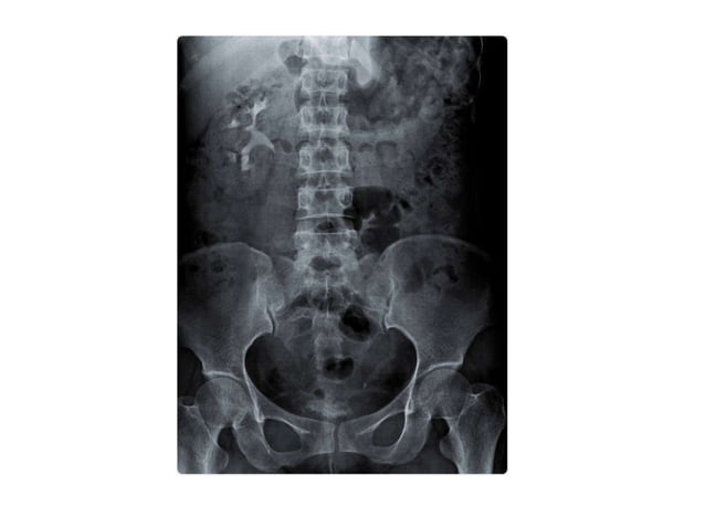 Patient preparation for radiological procedure | PPTX