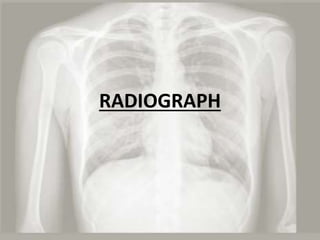 Patient preparation for radiological procedure | PPTX