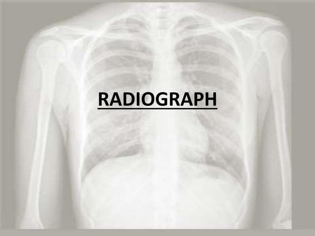 Patient preparation for radiological procedure | PPTX
