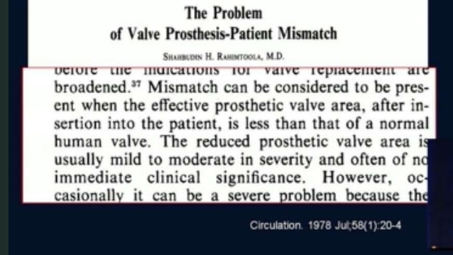 HEART VALVES PROSTHESIS MISMATCH -FACTS OR FICTION | PPT