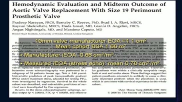HEART VALVES PROSTHESIS MISMATCH -FACTS OR FICTION | PPT
