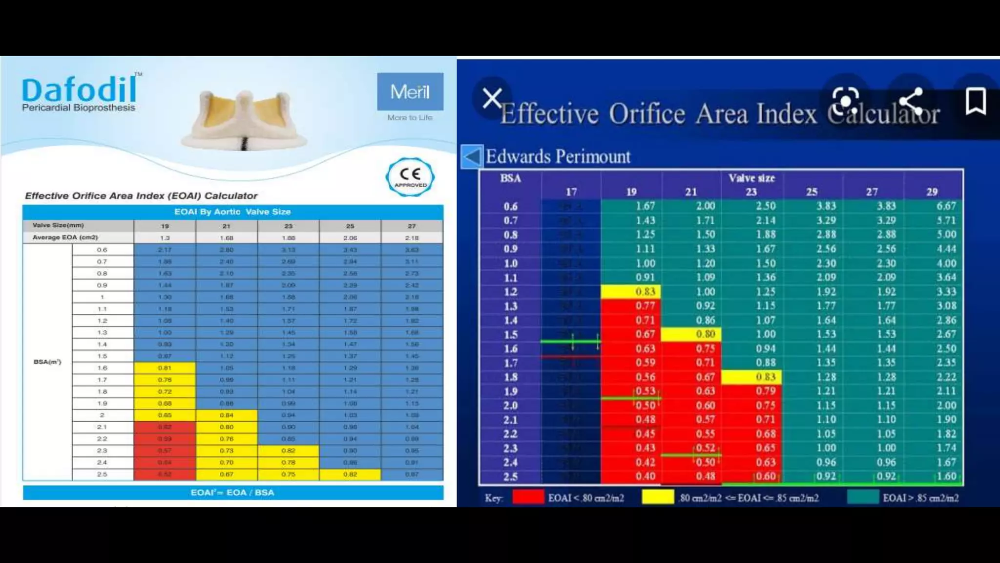 Patient prosthetic mismatch | PPTX