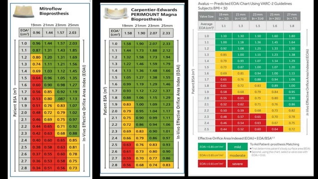Patient prosthetic mismatch | PPTX
