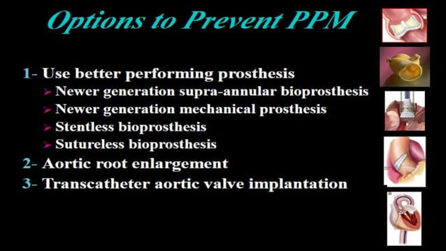Patient prosthetic mismatch | PPTX