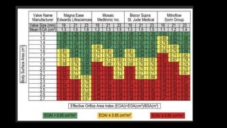 Patient prosthetic mismatch | PPTX