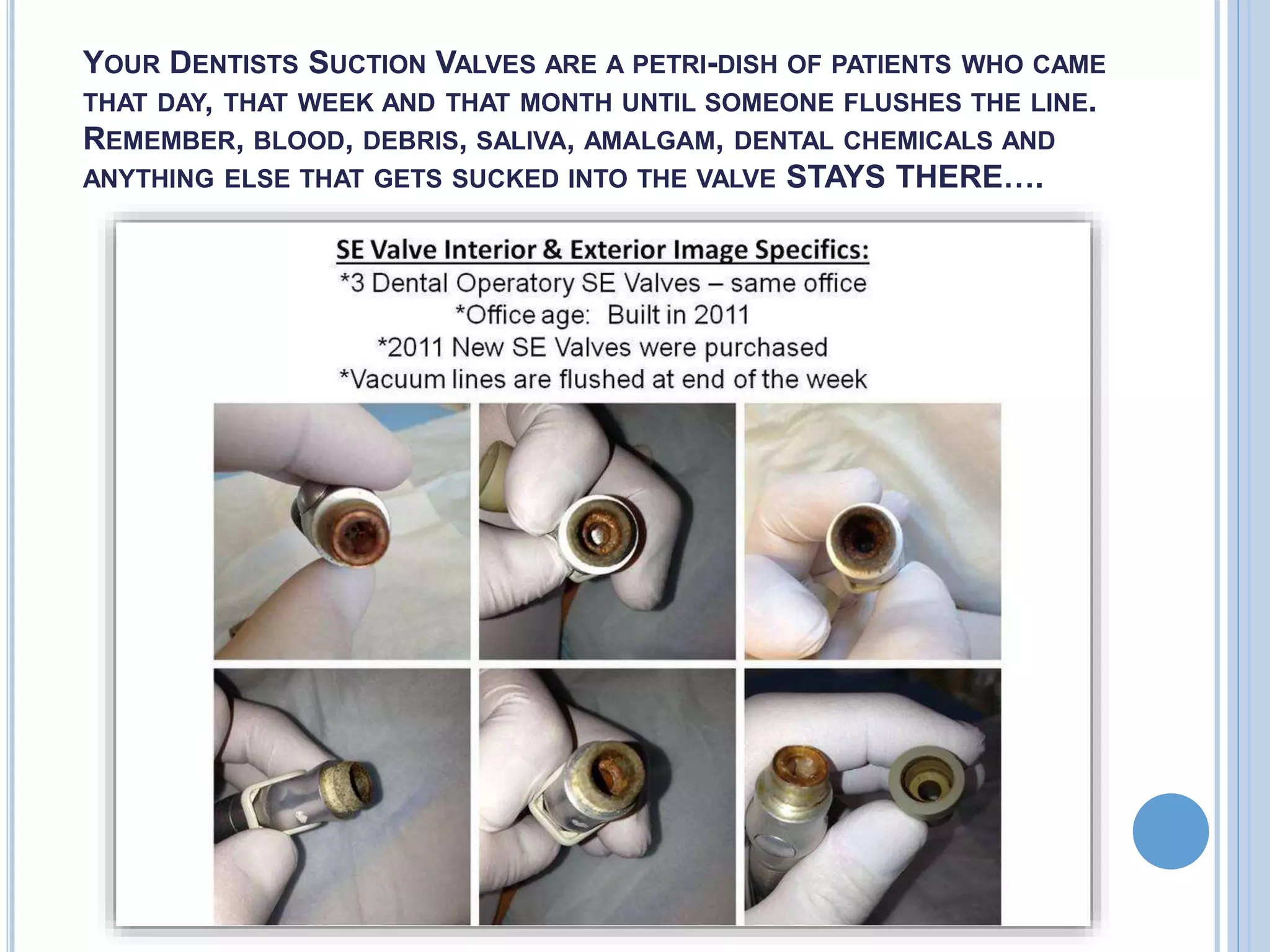 Patients Guide To Dental Suction Safety and Your Health | PPTX