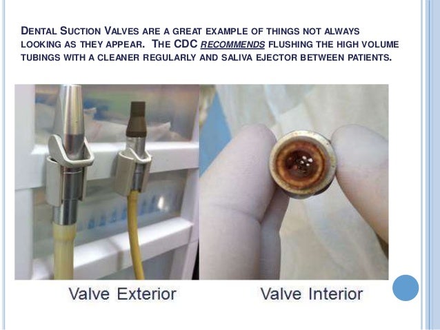 Patients Guide To Dental Suction Safety and Your Health