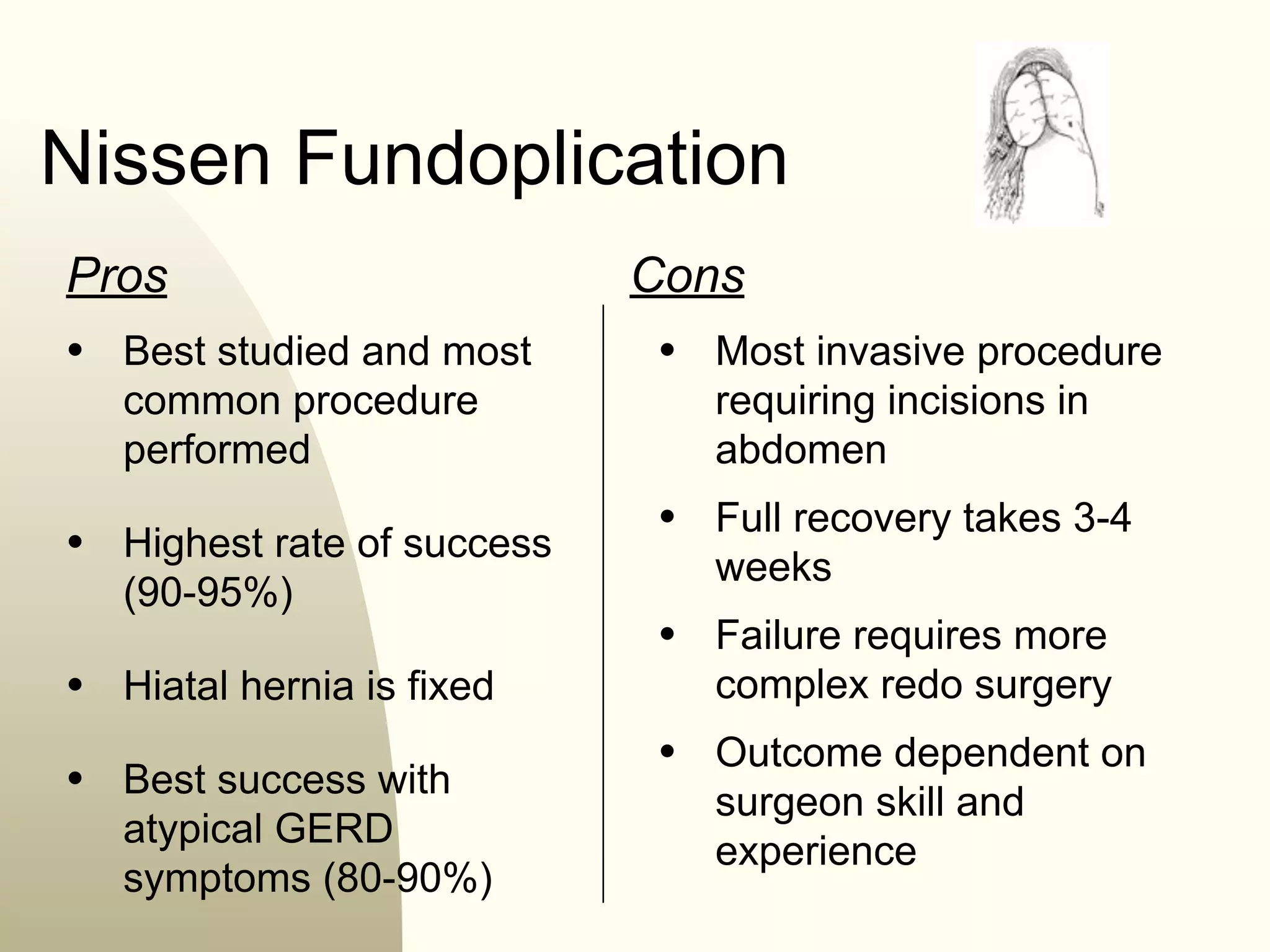 Surgical Options For GERD | KEY