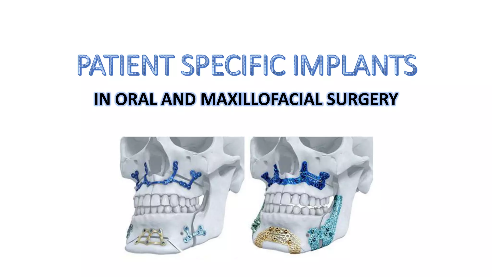 PATIENT SPECIFIC IMPLANTS.pptx