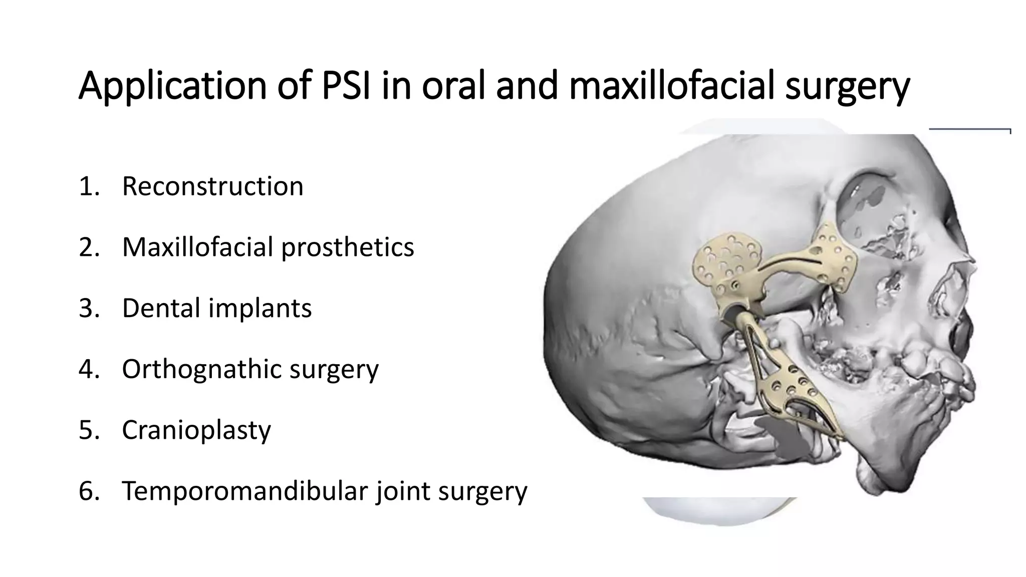 Patient Specific Implants Pptx