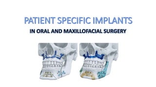 PATIENT SPECIFIC IMPLANTS.pptx