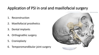 PATIENT SPECIFIC IMPLANTS.pptx