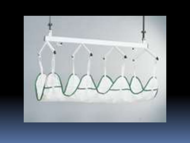 Patients safety transfers and lifting | PPTX | First Aid | Injuries