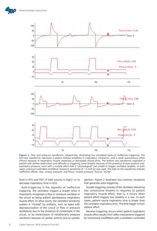Patient - Ventilator Asynchrony JBP Review.pdf