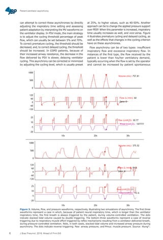 Patient - Ventilator Asynchrony JBP Review.pdf