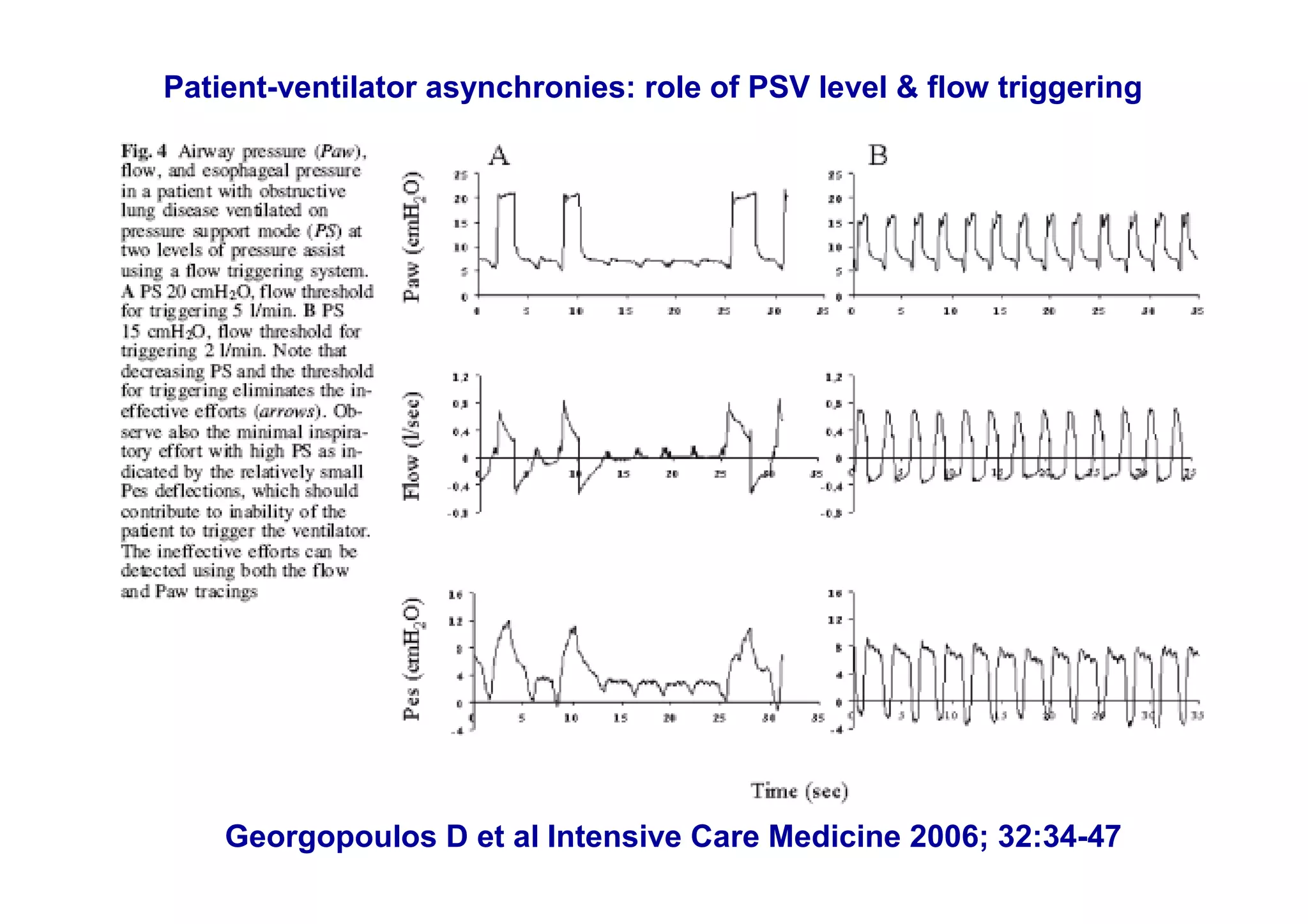 Patient ventilator interactions during mechanical ventilation | PDF