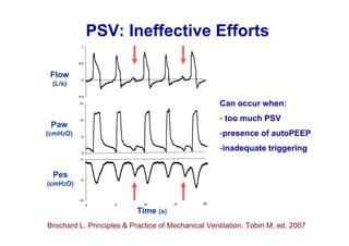Patient ventilator interactions during mechanical ventilation | PDF