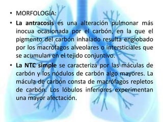 Sarcoidosis, Asbestosis, silicosis. | PPTX