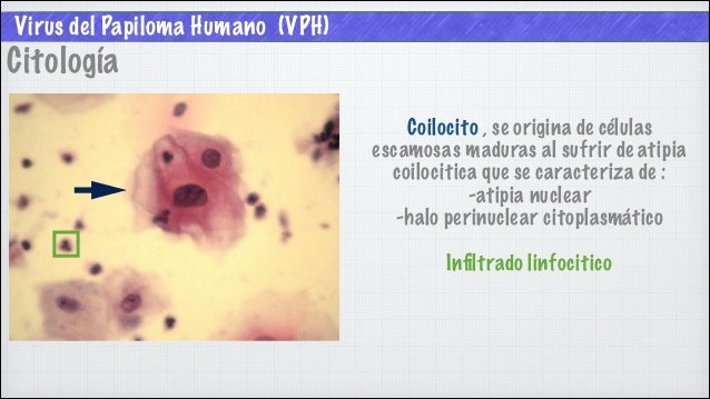 Patología Ginecológica