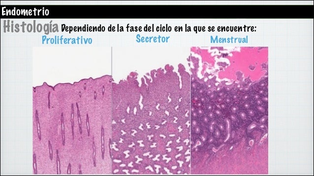 Patología Ginecológica