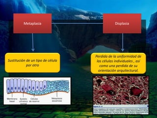 DIFERENCIACIÓN Y ANAPLASIA | PPTX