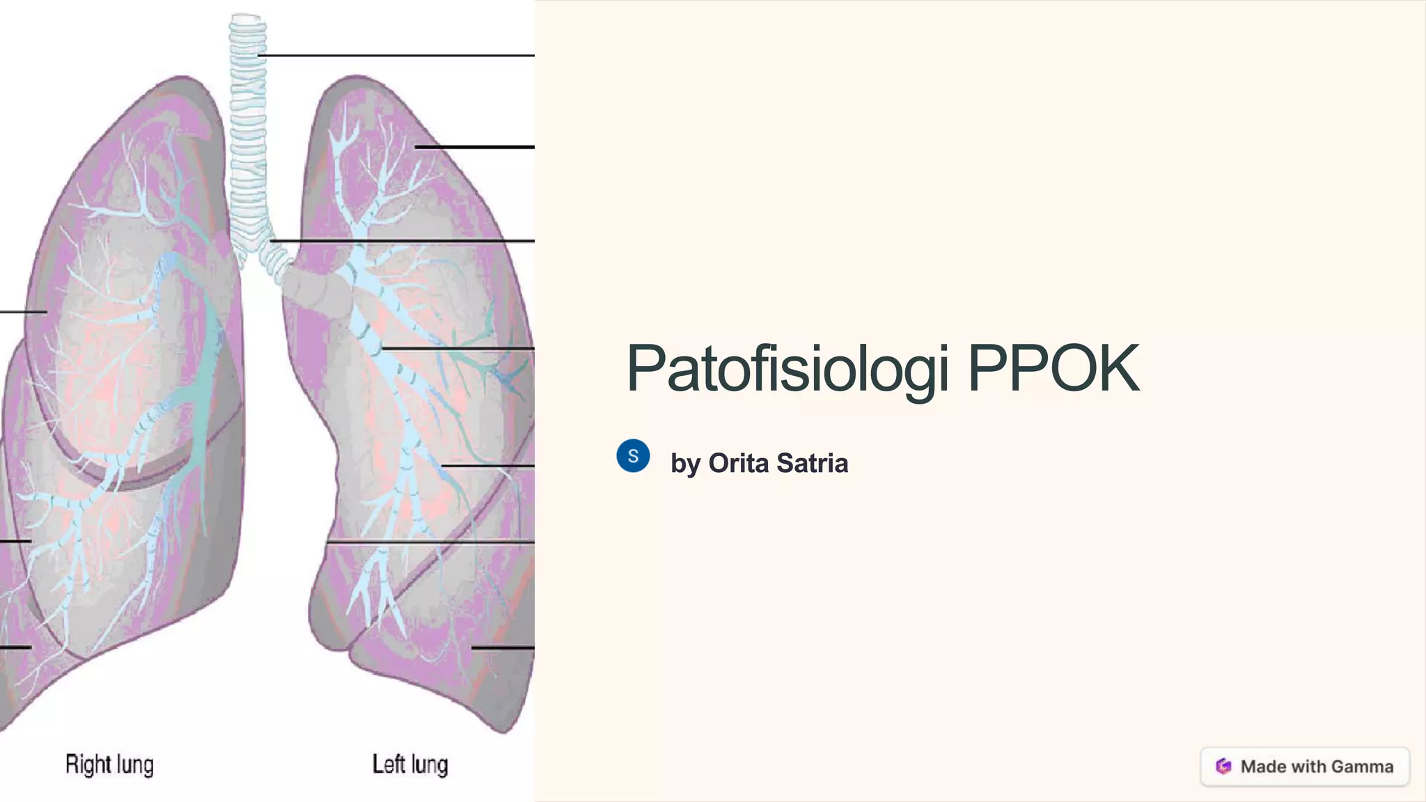 Patofisiologi-PPOK.pptx