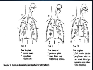 Patofisiologi batuk | PPTX