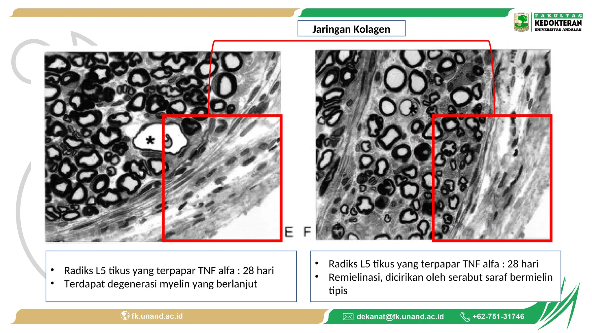 Patofisiologi HNP untuk bahan bacaan.ppt