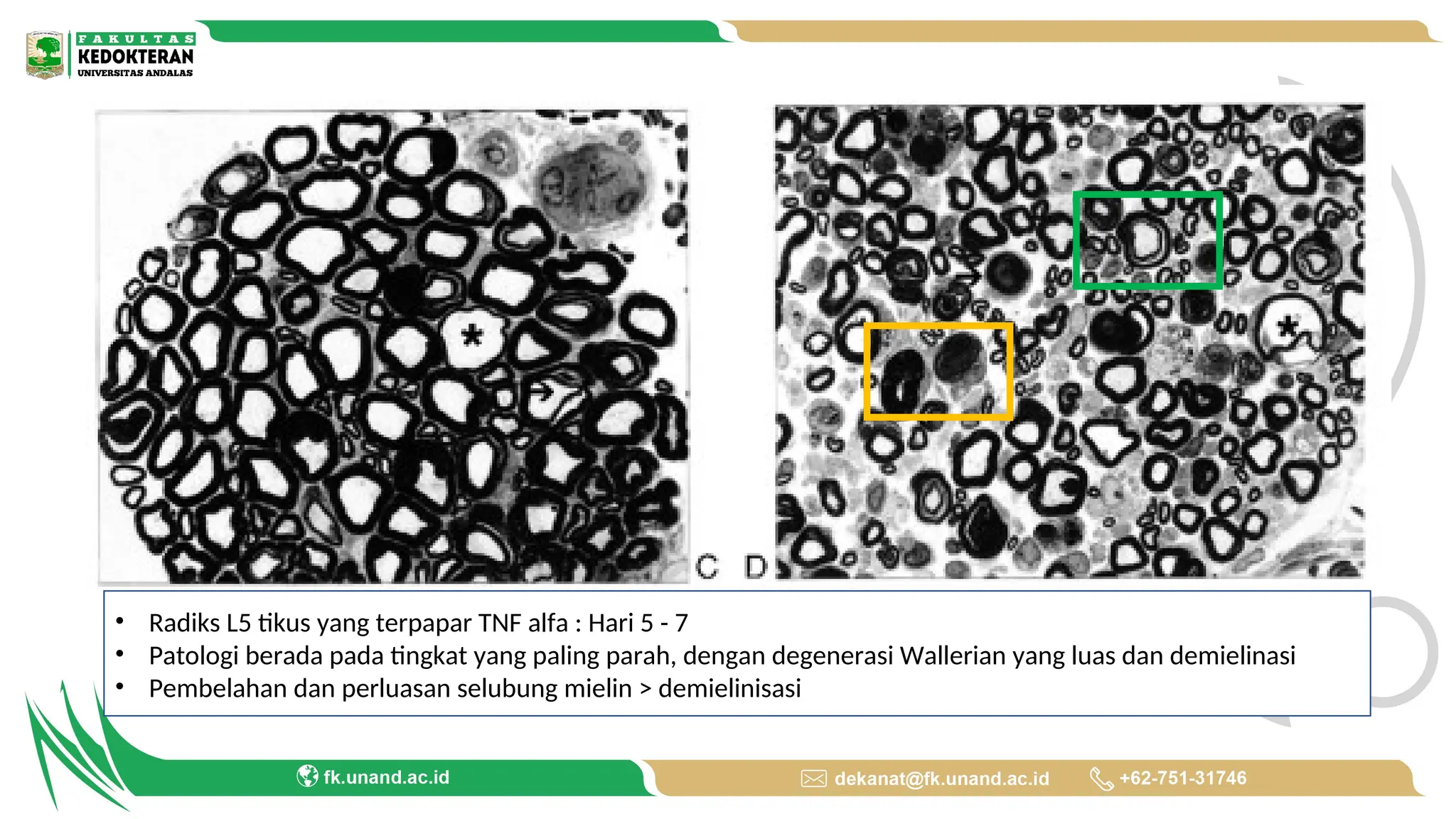 Patofisiologi HNP untuk bahan bacaan.ppt