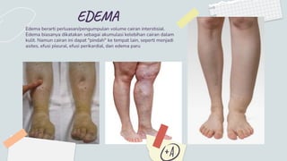 PATOFISIOLOGI KELOMPOK 1 (REVISI).pptx