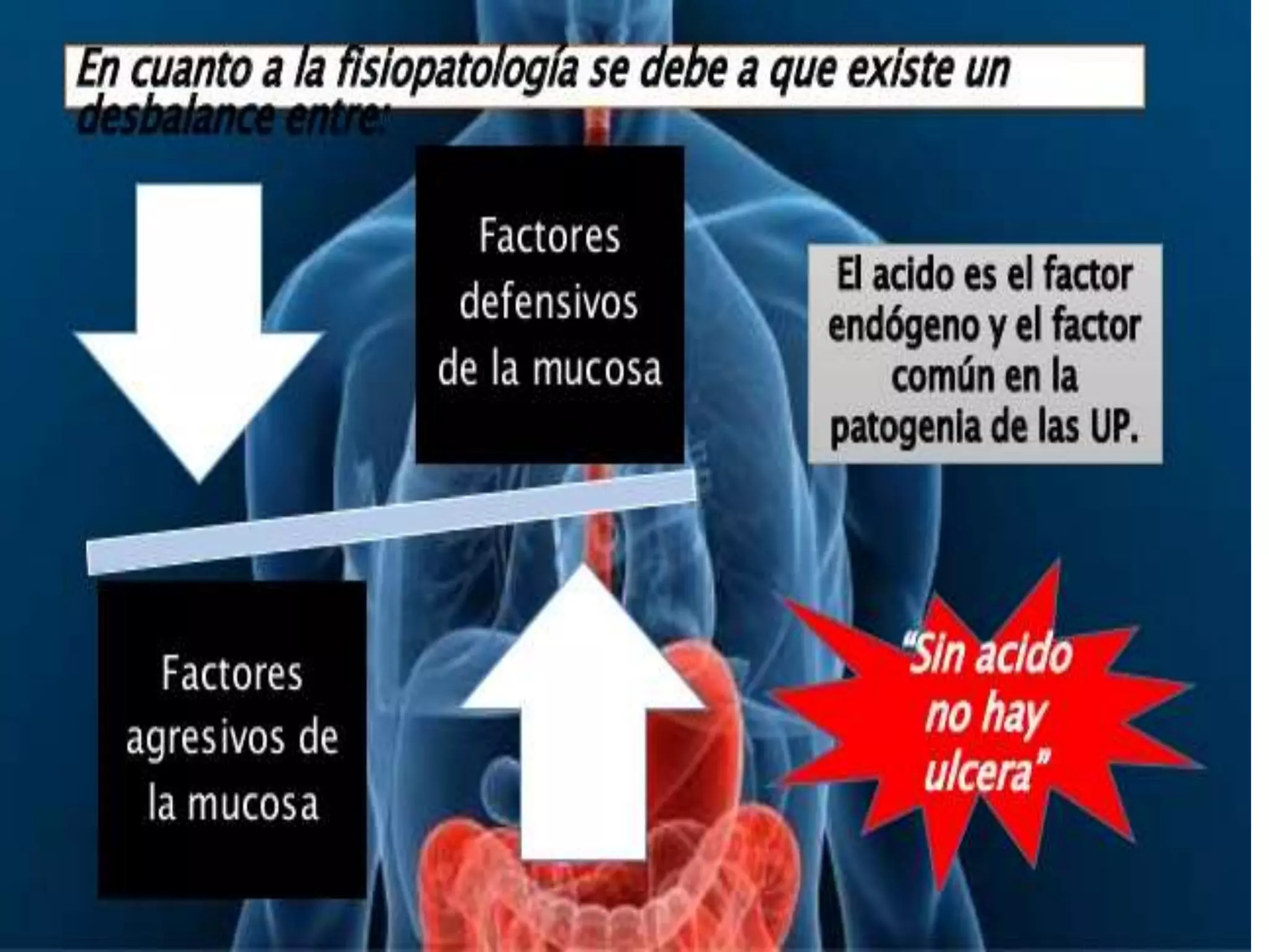 PEPTIC ULCER TUKAK LAMBUNG Patofisiologi peptic ulcer | PPTX